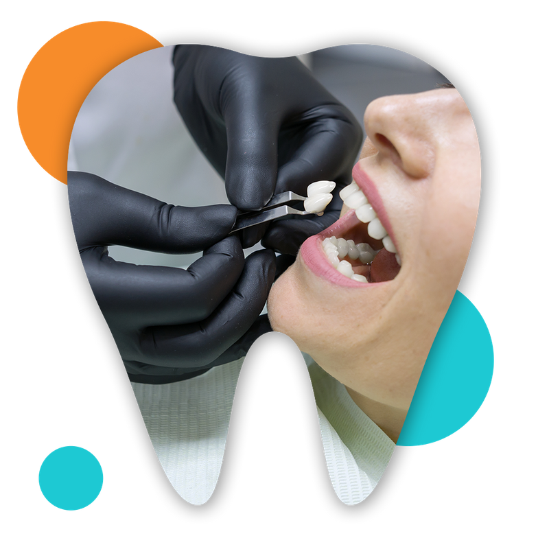 Hangover Image Of Tooth Extraction